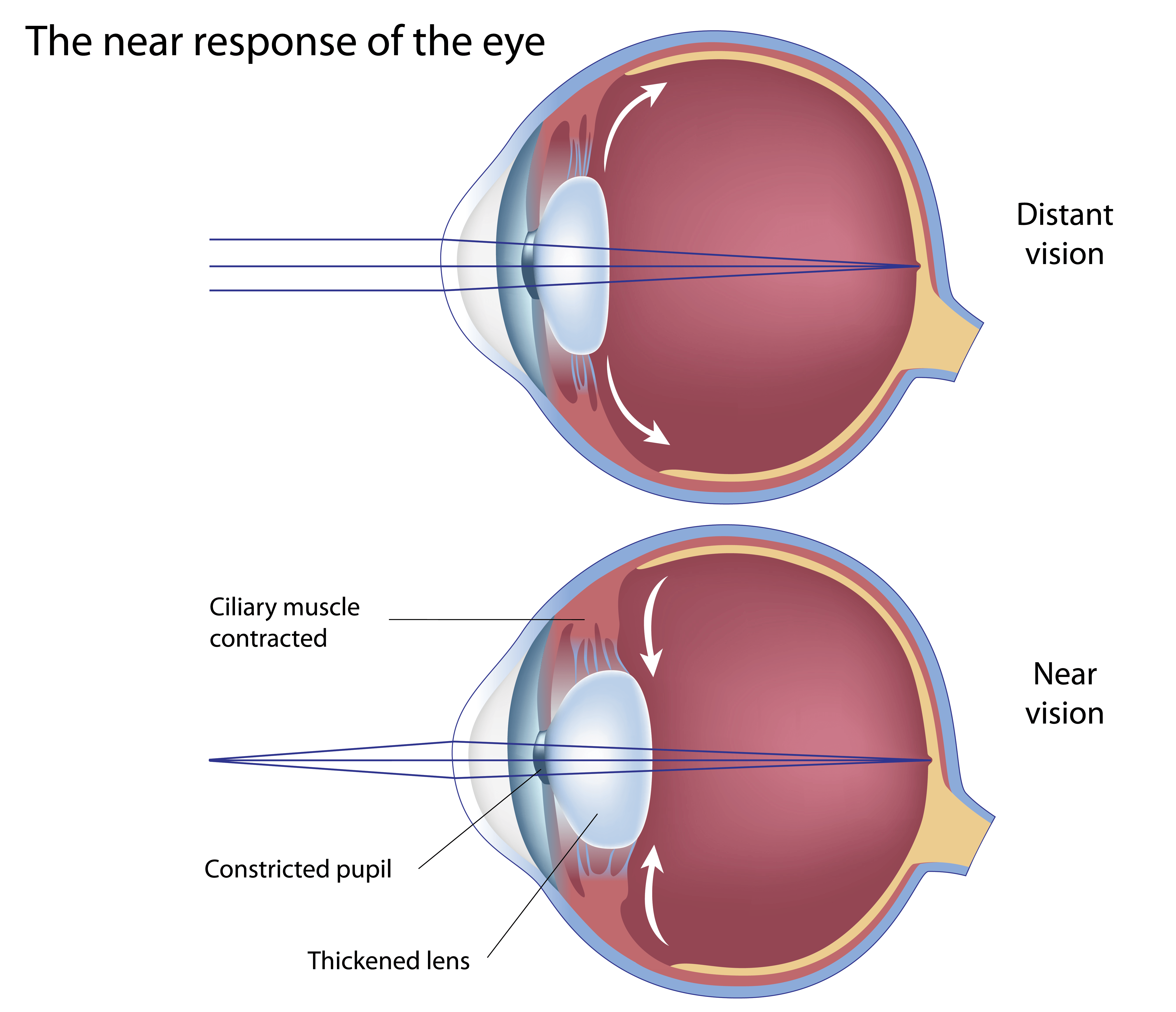 MyBetterSight